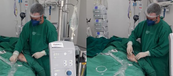 Power PICC: como instalar no paciente internado na UTI?